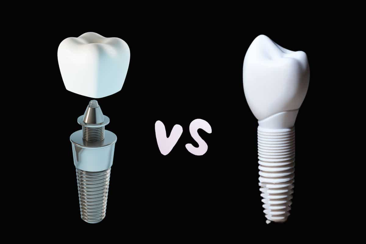 Titanium vs Ceramic Implants: Which is Right for You?